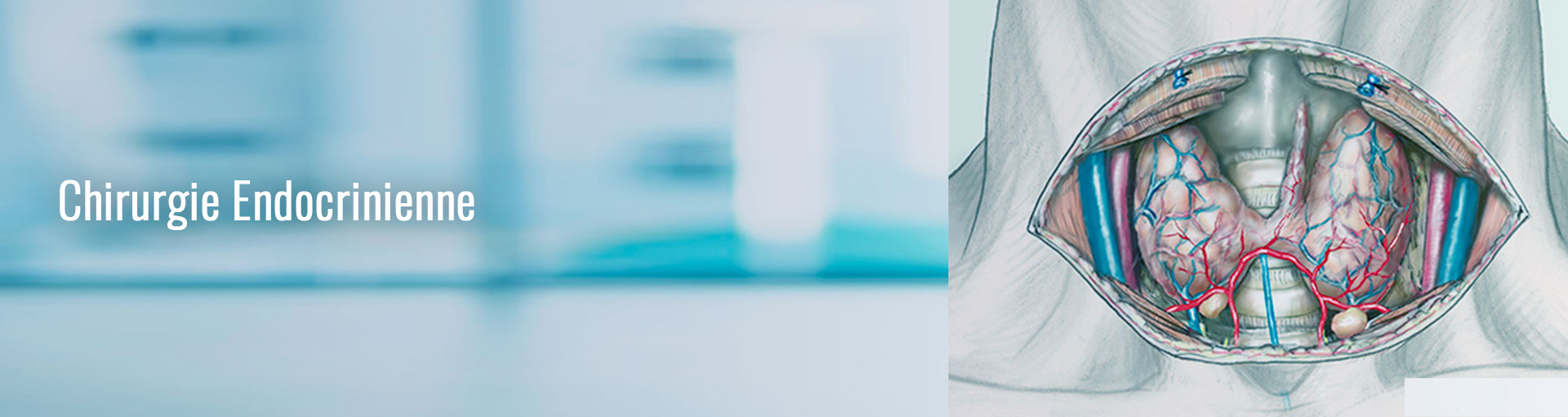 Opération du Goitre Multinodulaire - Groupe Must, clinique à Paris